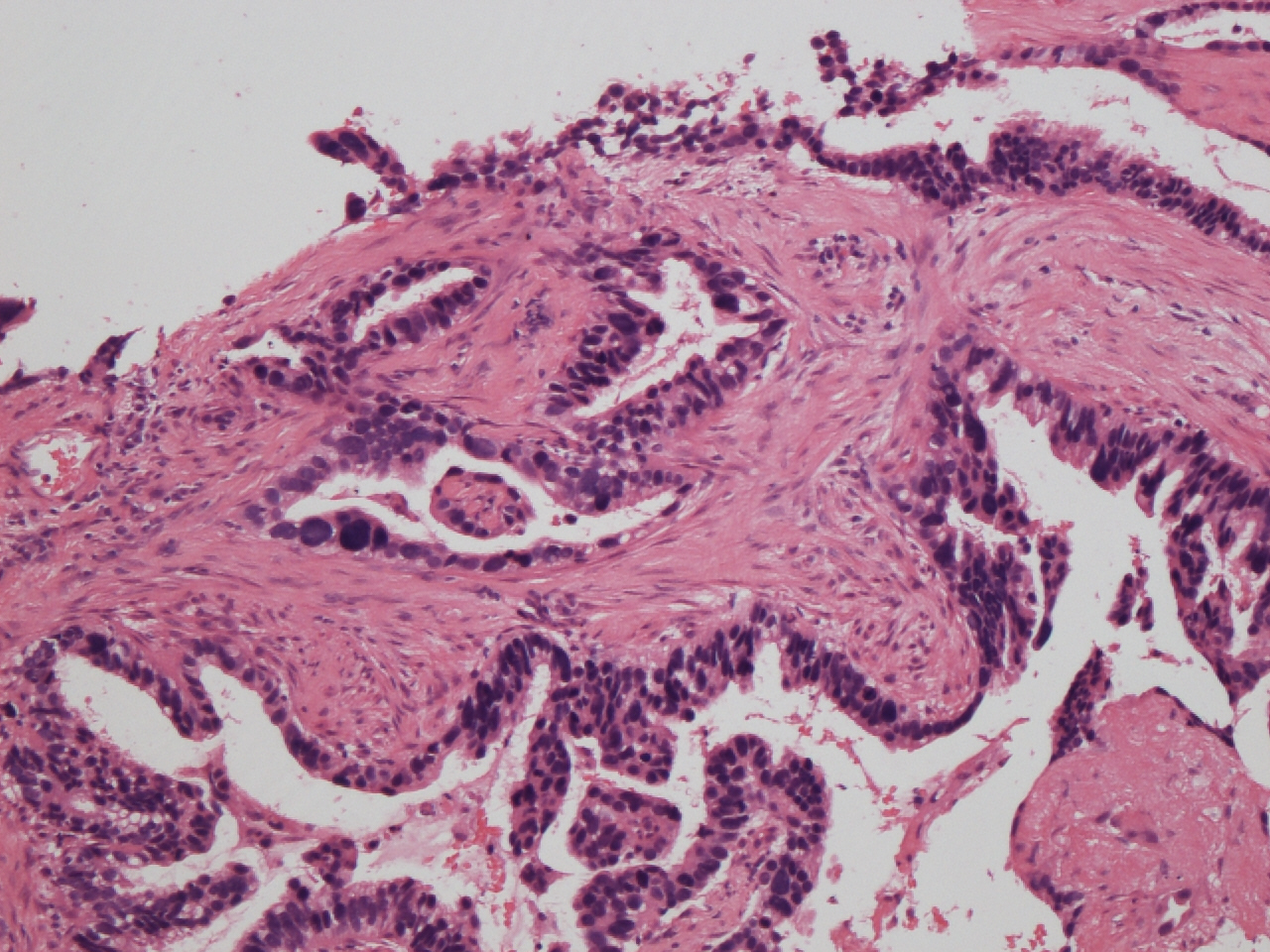 Lung Pathology | Edinburgh Pathology | Pathology