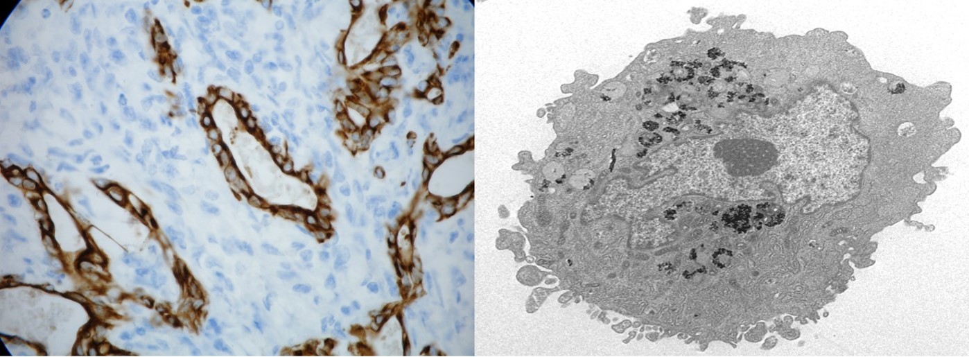 Soft Tissue, Bone and Joint Pathology | Pathology
